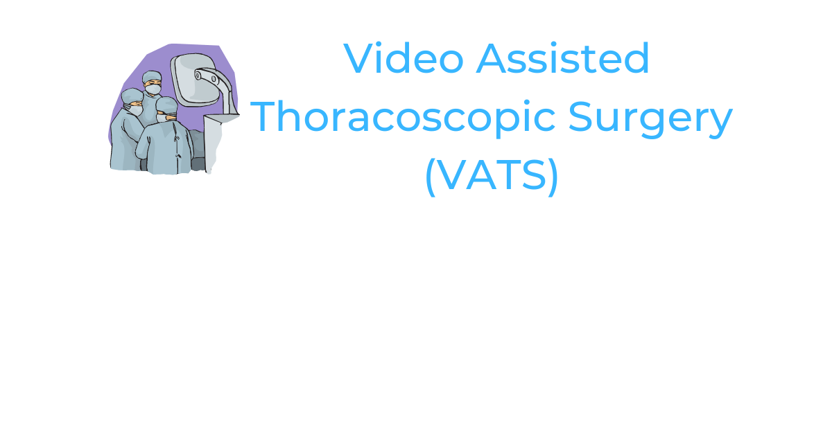 VATS Surgery in India: Less Invasive, More Effective - Dr Kamran Ali